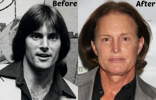 Kisah Transgender Bruce Jenner akan Dijadikan Serial TV