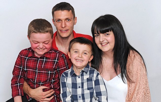 Alergi Antibiotik Hampir Membuat Anak 6 Tahun Buta