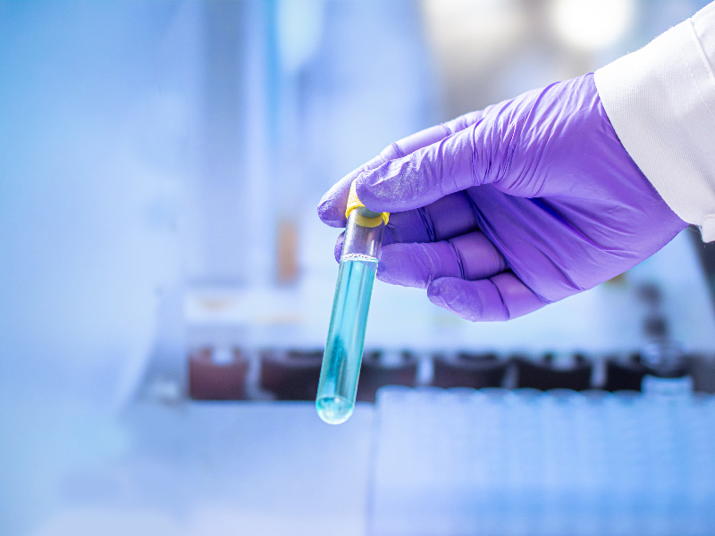 Kemenkes Tetapkan Harga Tertinggi Tes Swab PCR Rp900 Ribu Kemenkes Tetapkan Harga Tertinggi Tes Swab PCR Rp900 Ribu
