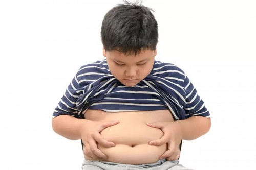Simak! Ini 6 Cara Mencegah Obesitas pada Remaja