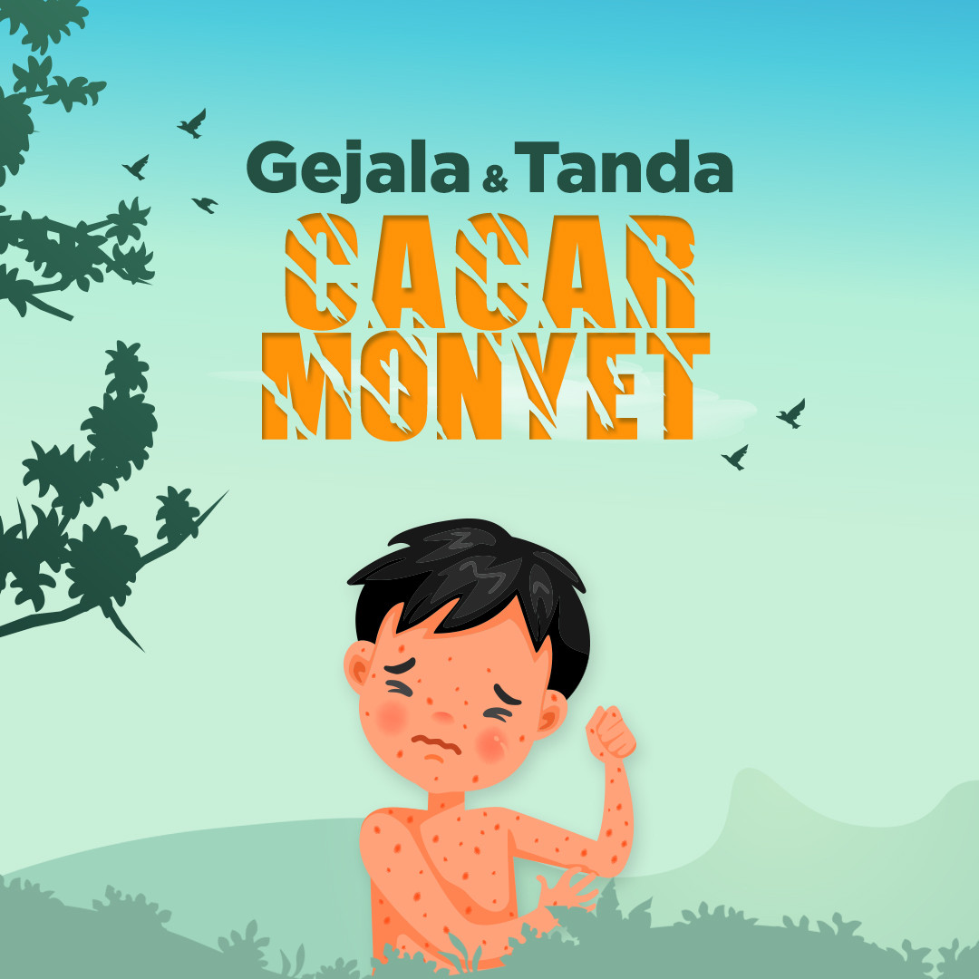 Gejala dan Tanda Cacar Monyet