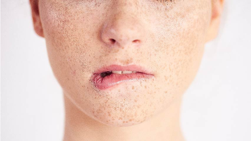 Warna Kulit Tidak Merata, Begini Tips Mengatasinya