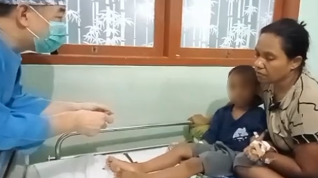 Viral! Bocah 4 Tahun di NTT Meninggal Dunia Setelah Digigit Anjing Rabies Viral! Bocah 4 Tahun di NTT Meninggal Dunia Setelah Digigit Anjing Rabies